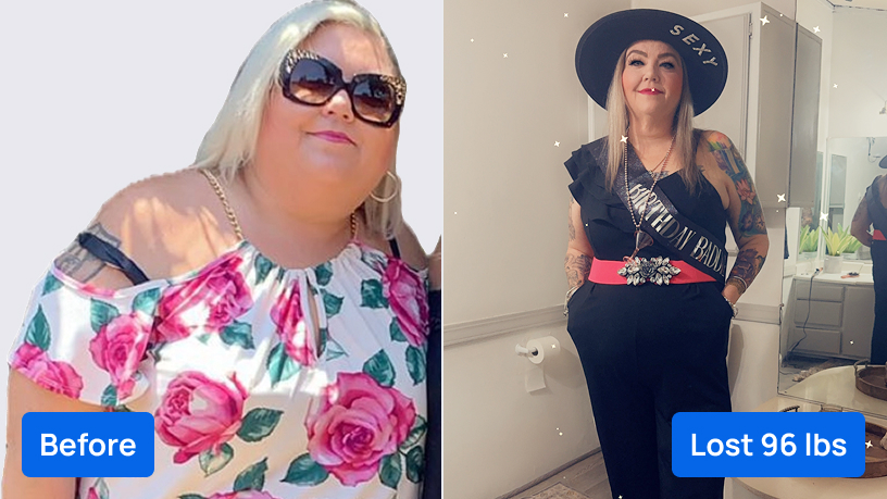 Gastric Band Removal – Procedure, Recovery & Side Effects