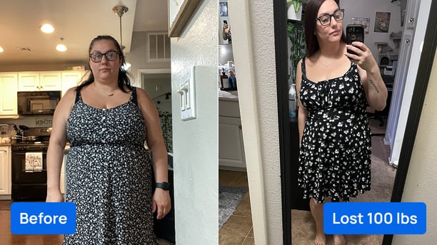 Gastric Band Removal – Procedure, Recovery & Side Effects